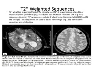 MRI PHYSICS FOR RADIOLOGY RESIDENTS INDIA | PPTX