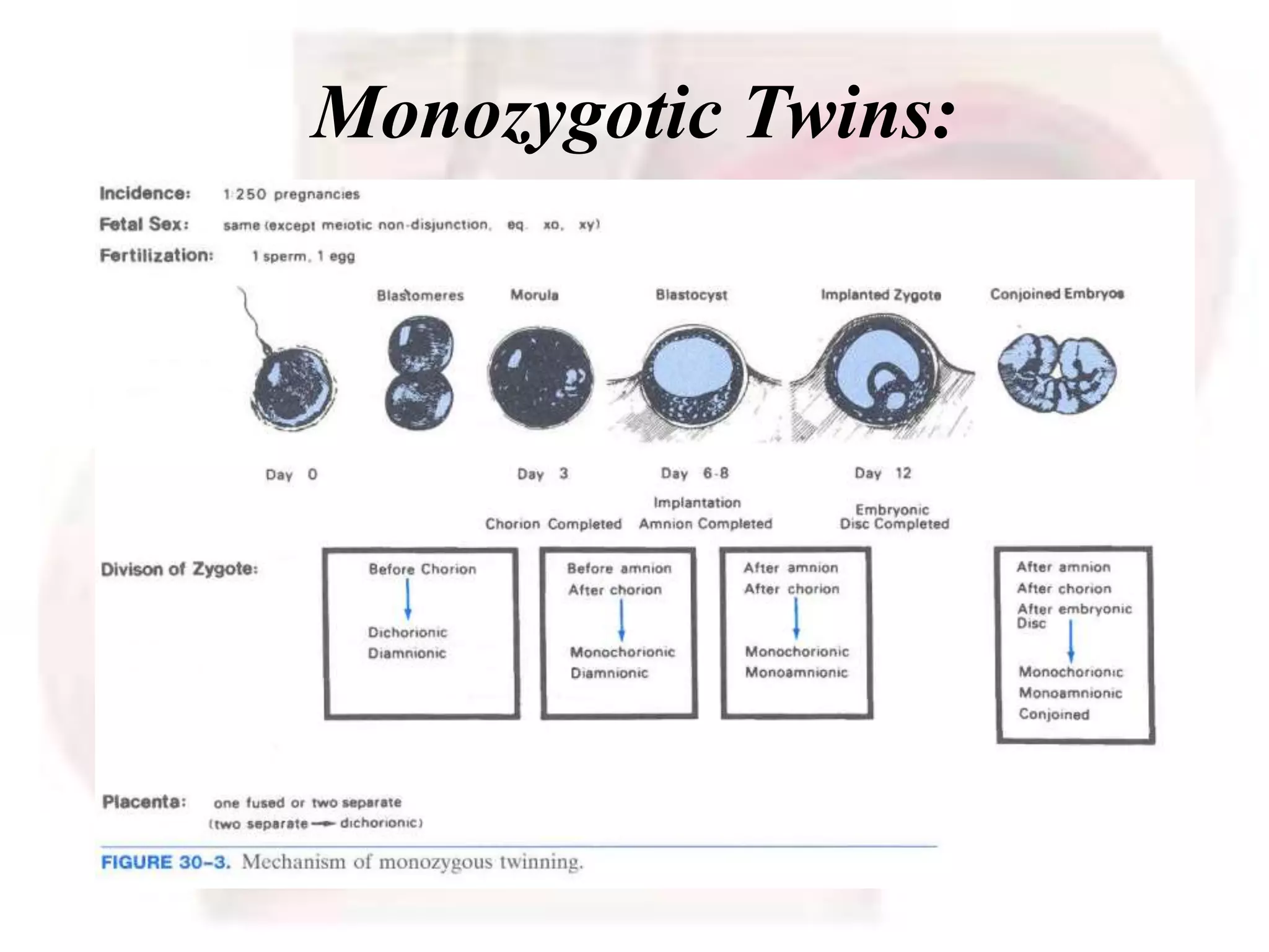Ppt multiple pregnancy | PPTX