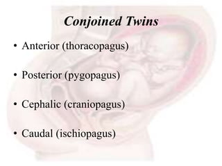 Ppt multiple pregnancy | PPTX
