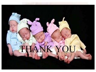 Ppt multiple pregnancy | PPTX