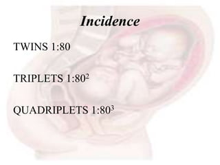 Ppt multiple pregnancy | PPTX
