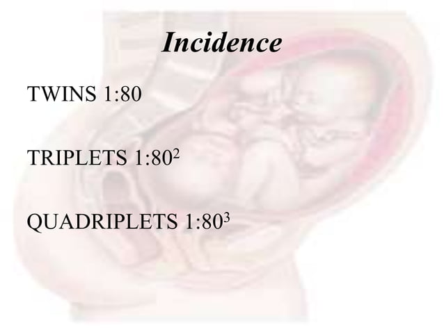 Ppt multiple pregnancy | PPTX