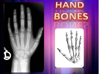 NAME OF THE BONES (Science 1º Primaria) | PPTX