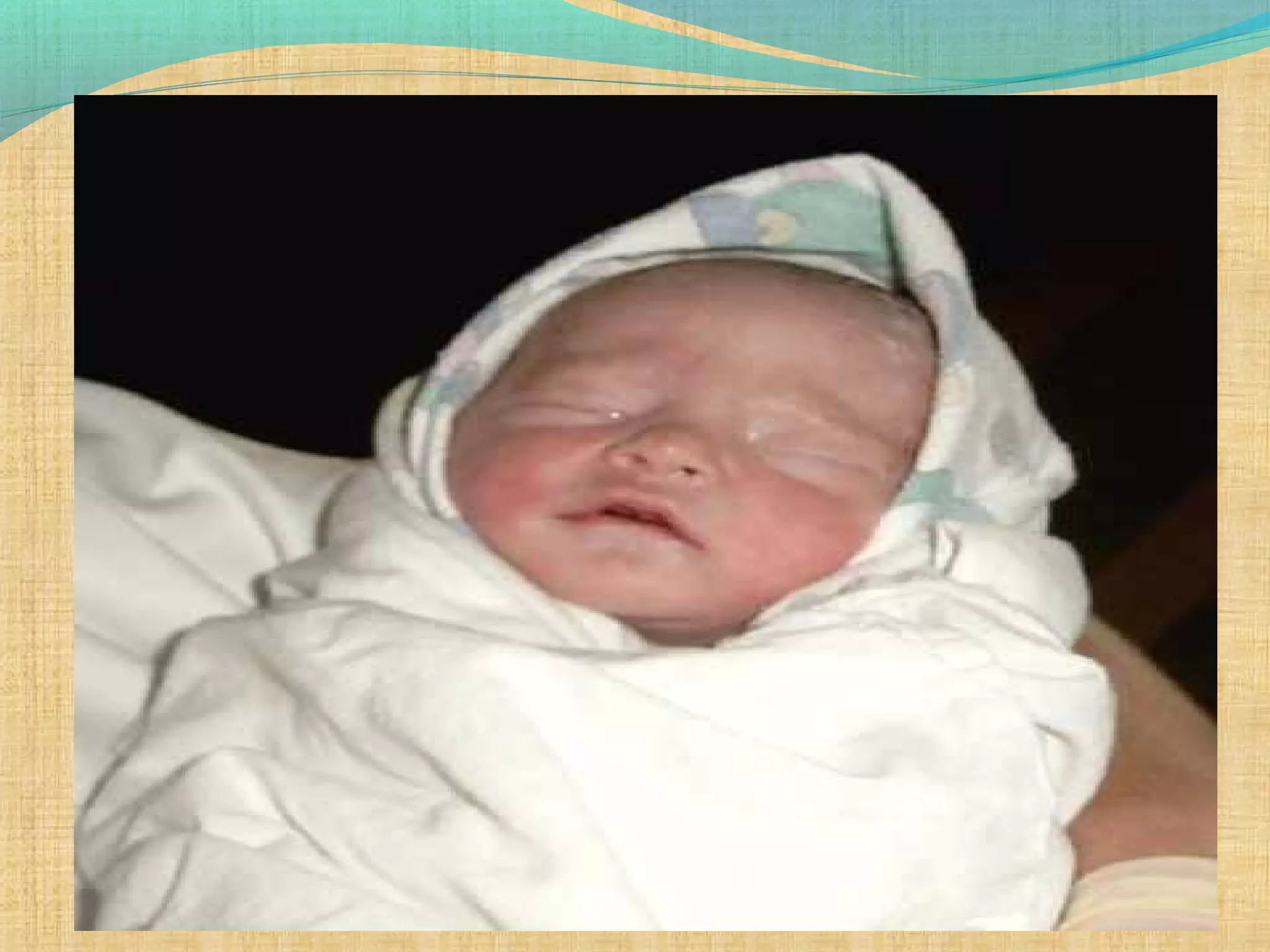NEWBORN CARE | PPT