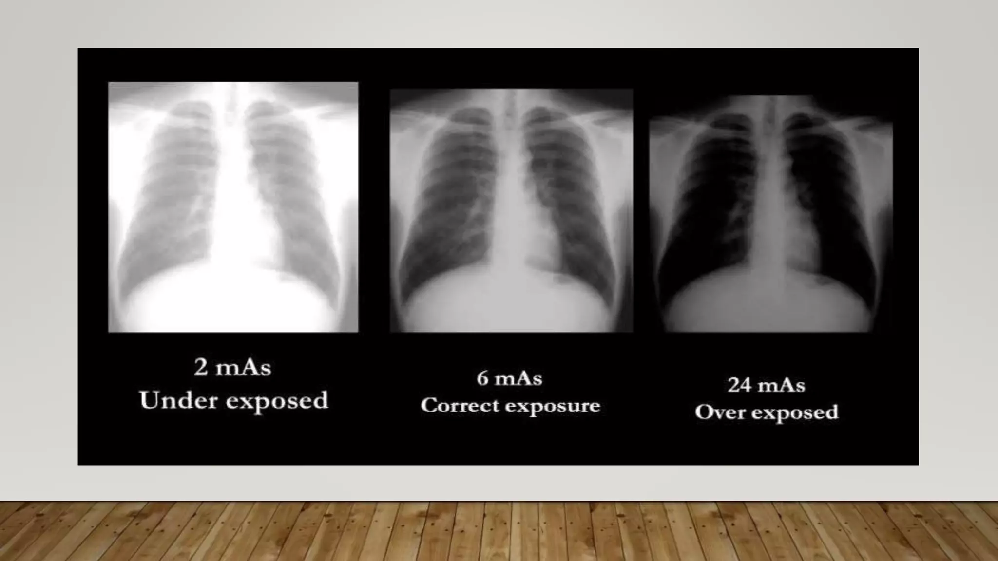 Normal chest X ray radiography interpretation | PPTX