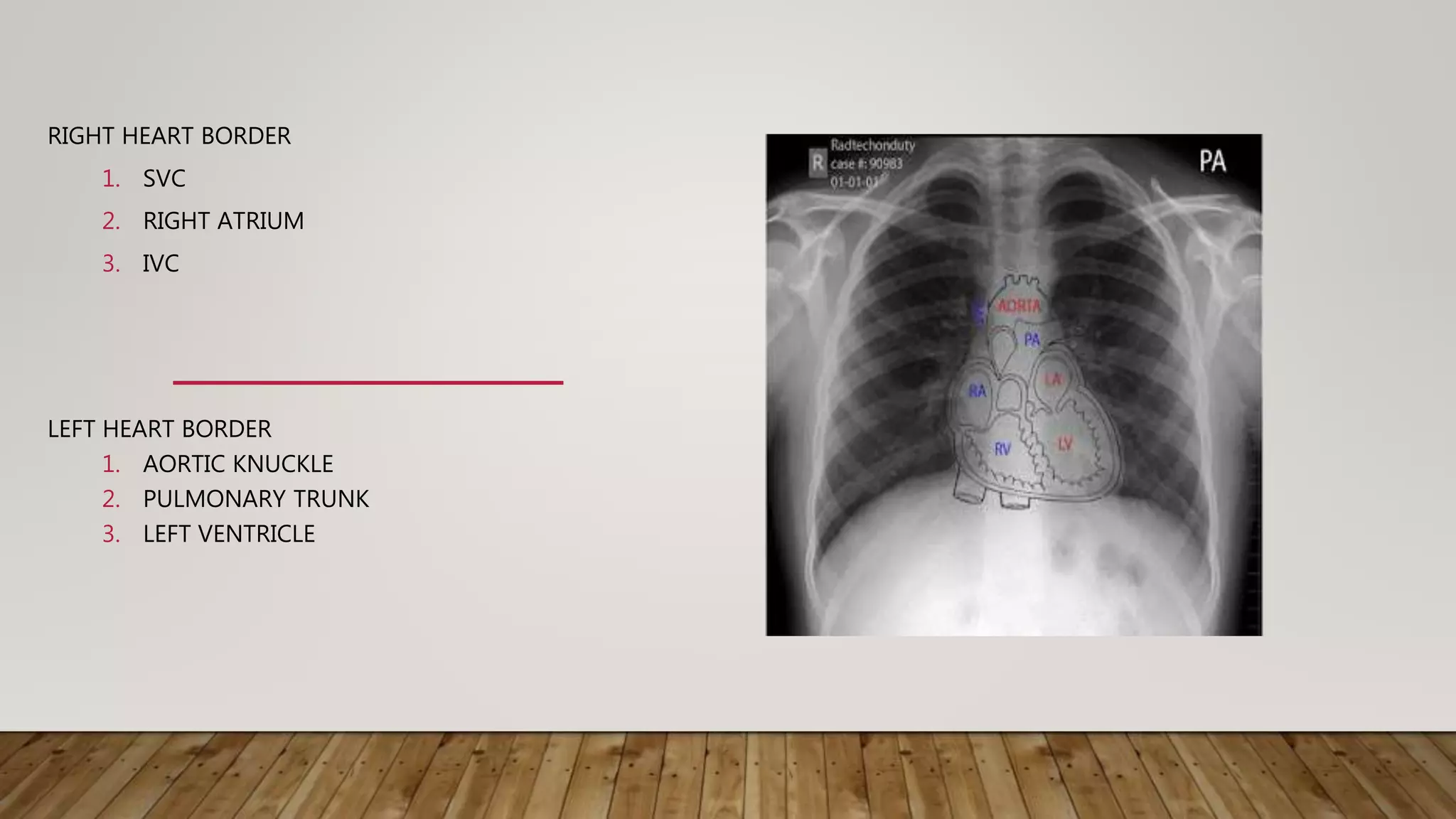 Normal chest X ray radiography interpretation | PPTX