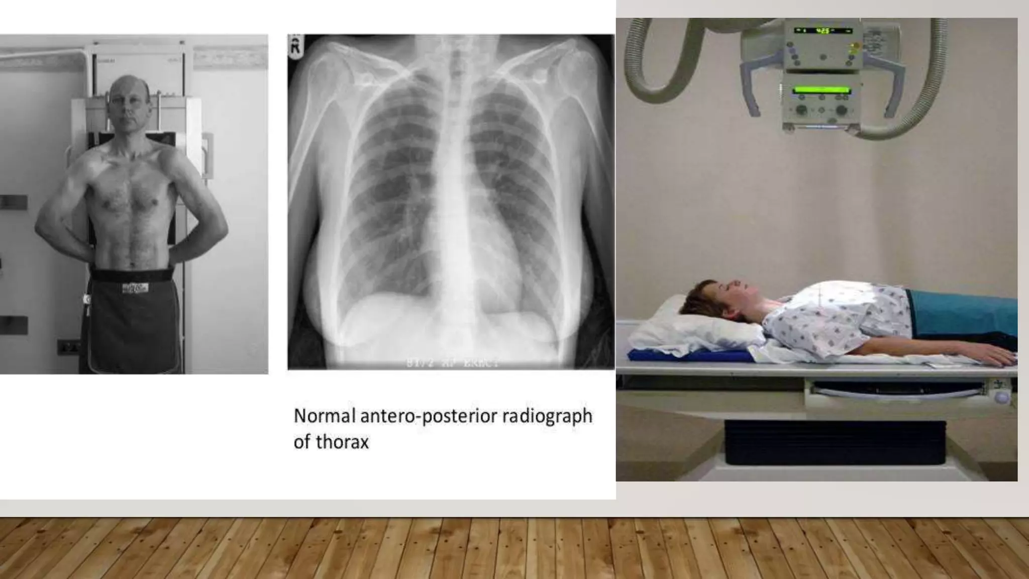 Normal chest X ray radiography interpretation | PPTX | Lung and ...