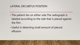 Normal chest X ray radiography interpretation | PPTX