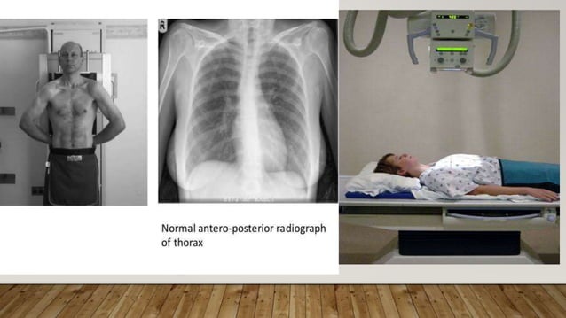 Normal chest X ray radiography interpretation | PPTX | Lung and ...