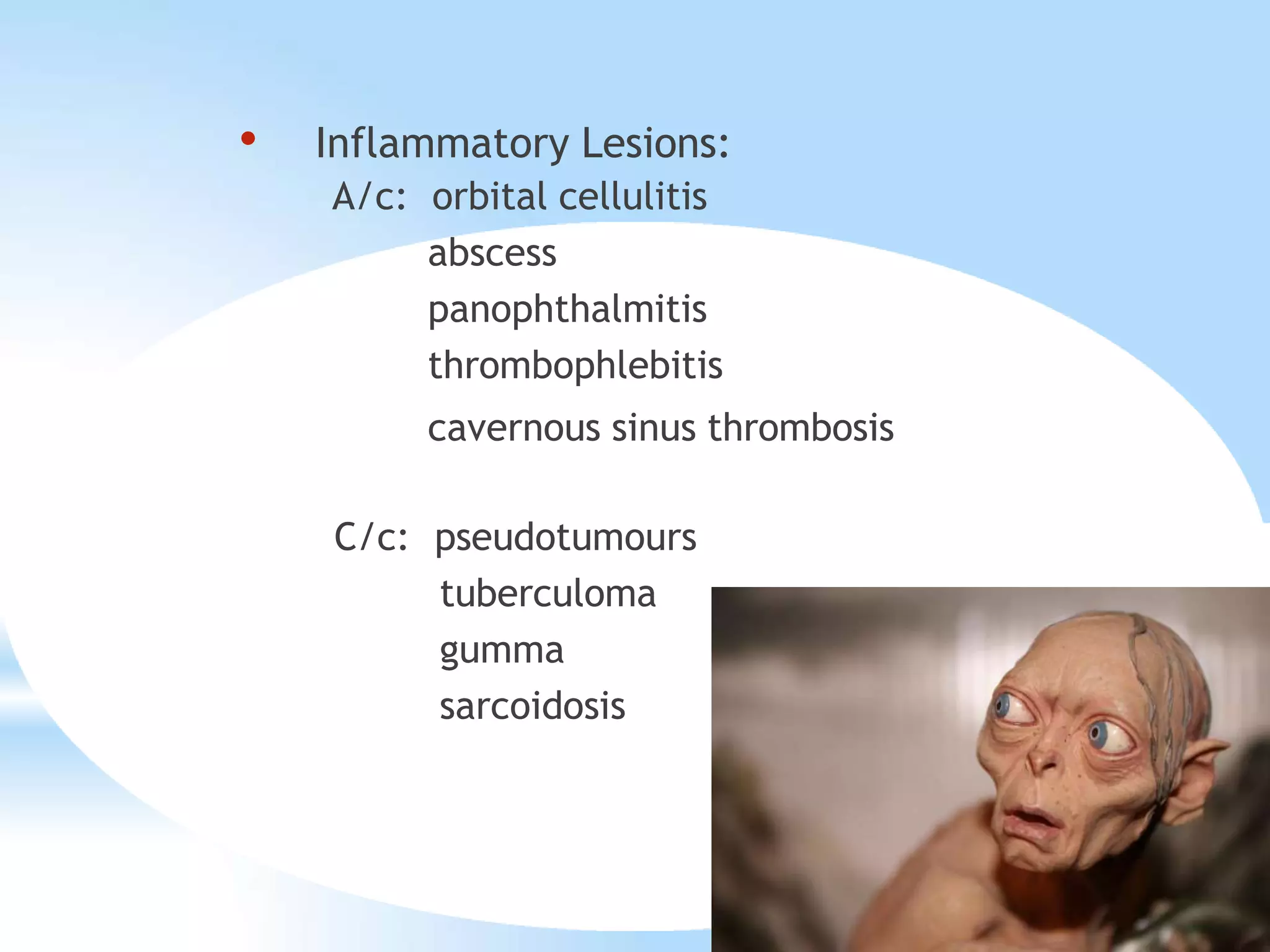 PPT OCULAR DISEASES 407 (1) (1).pptx