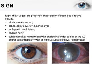 ppt ocular trauma cedera pada mata ppt.pptx