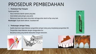 PPT Odon - Nabilah Putri - odontektomi.pptx