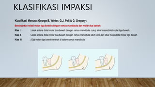PPT Odon - Nabilah Putri - odontektomi.pptx