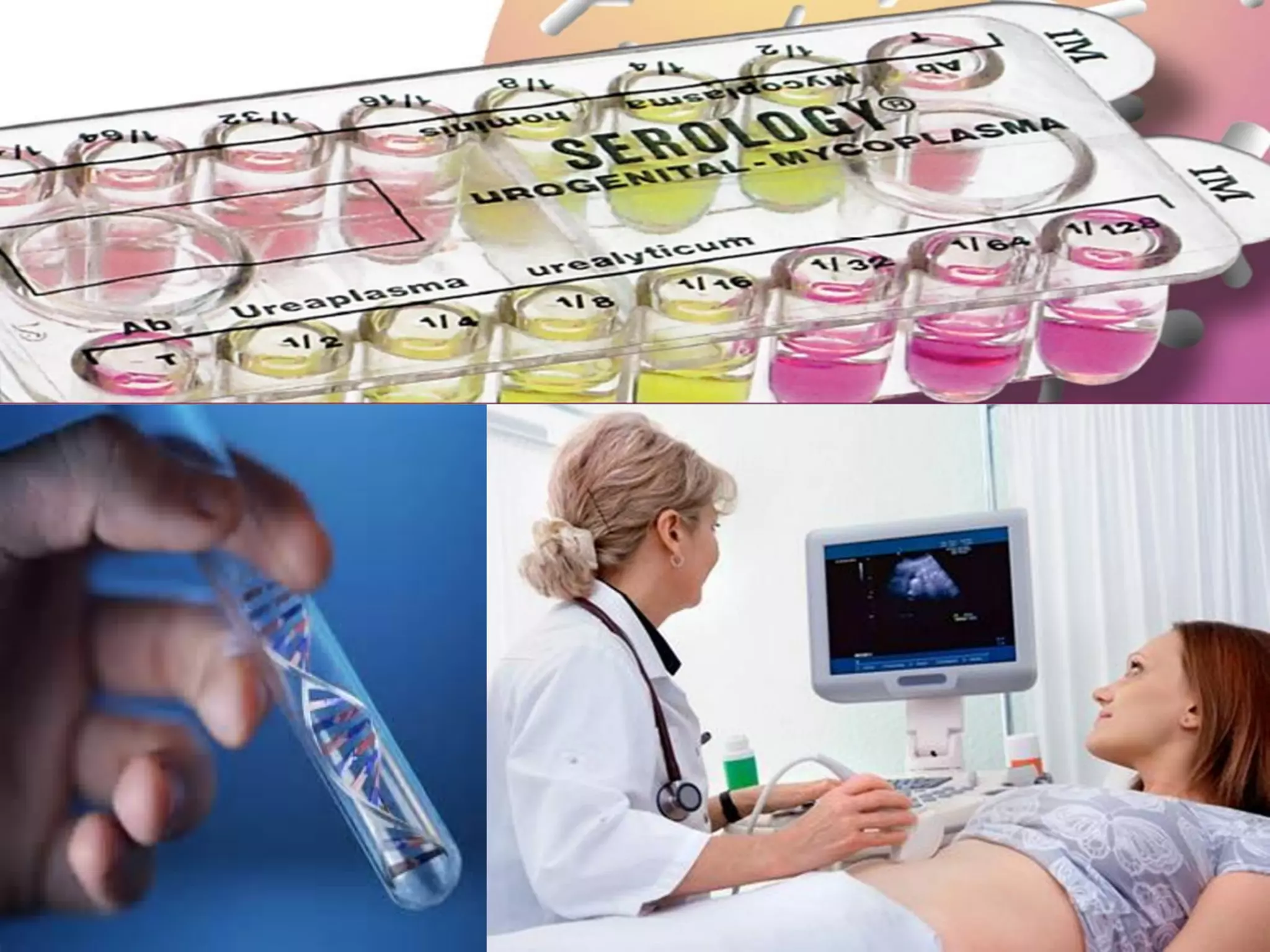 Antenatal Advice ppt. | PDF