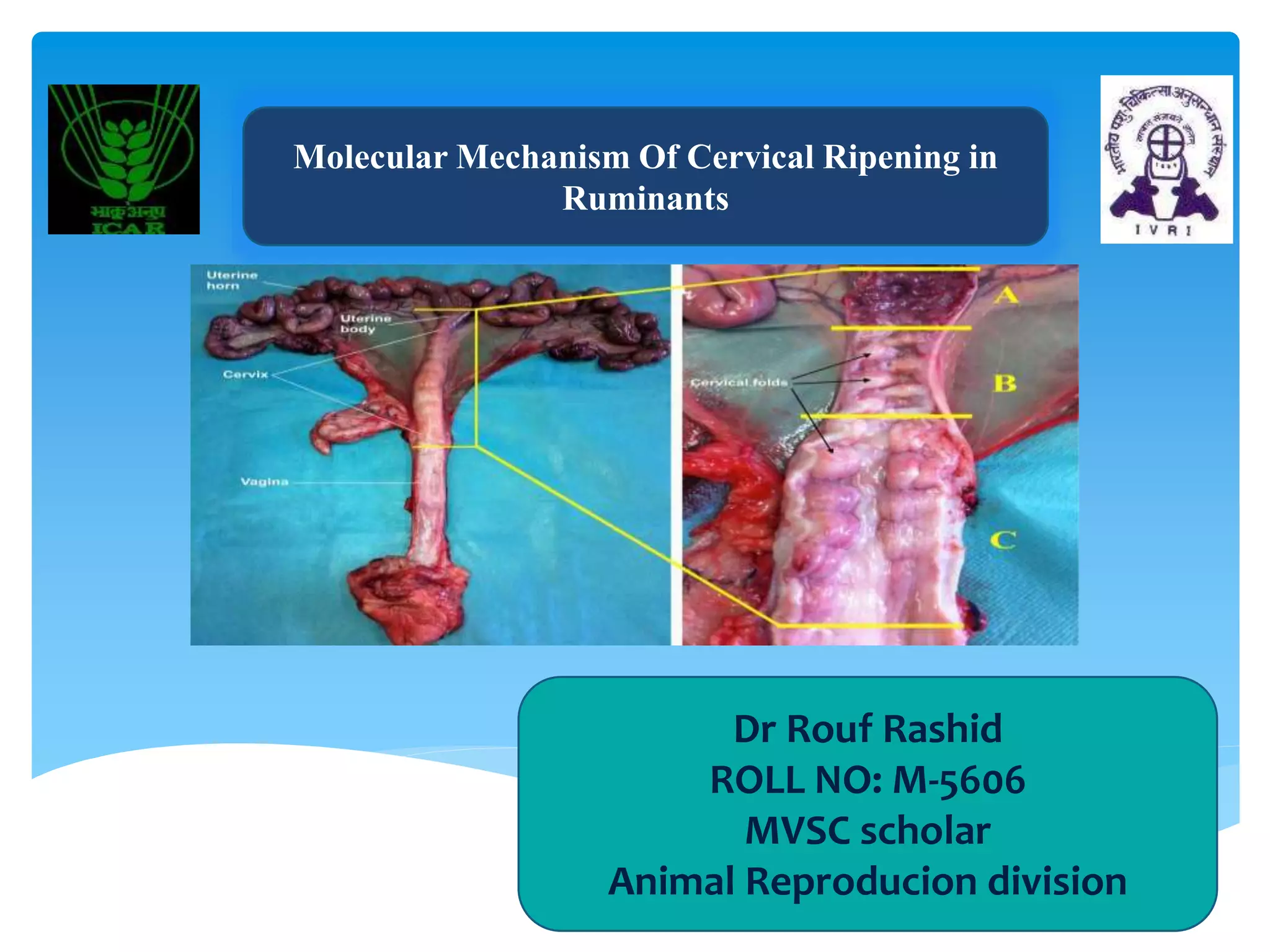 Molecular Mechanism of Cervical Ripening | PPT