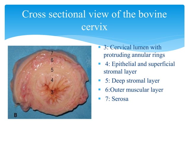 Molecular Mechanism of Cervical Ripening
