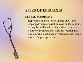 Ppt of epistaxis | PPT