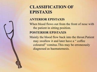 Ppt of epistaxis | PPT