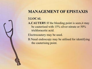 Ppt of epistaxis | PPT