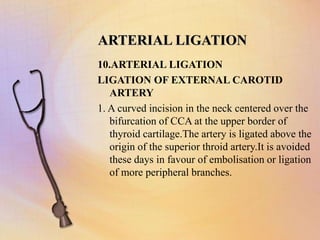 Ppt of epistaxis | PPT