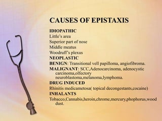 Ppt of epistaxis | PPT