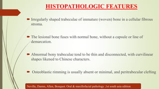 Polyostotic Fibrous Dysplasia Histology