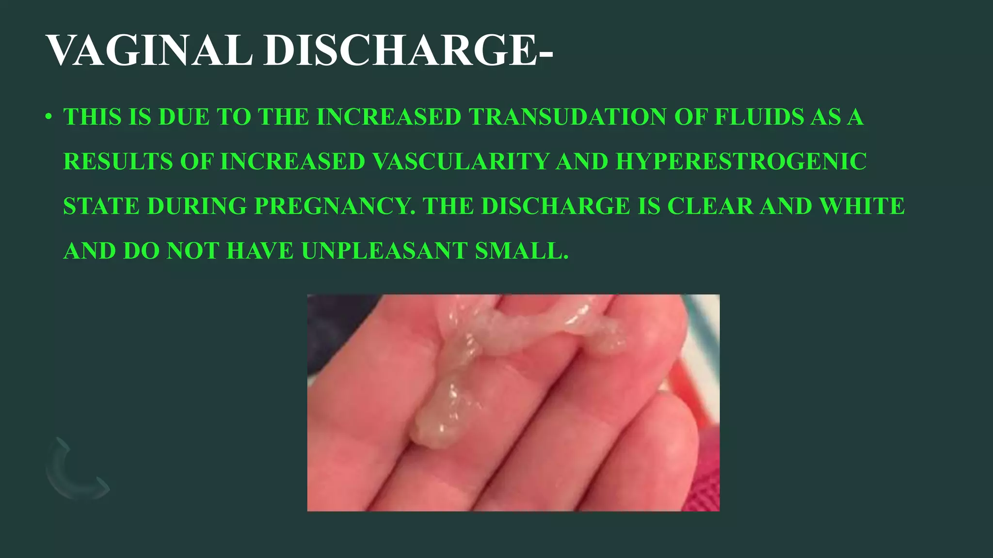 PPT OF MINOR AILMENTS OF PREGNANCY.pptx | Pregnancy | Reproductive Health