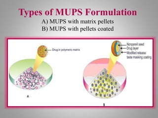 Multi Unit Pellet System (MUPS) | PPT