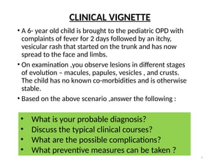 ppt of paediatric chicken pox and tetanus with vignette.pptx