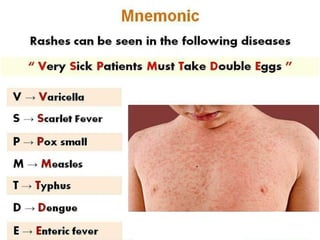 ppt of paediatric chicken pox and tetanus with vignette.pptx