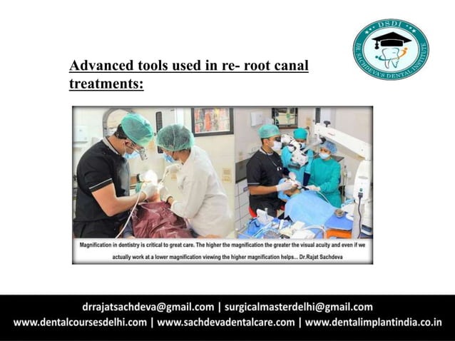 Re-root canal treatment| Root Canal Treatment| Advanced Root Canal ...