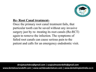 Re-root canal treatment| Root Canal Treatment| Advanced Root Canal ...