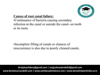 Re-root canal treatment| Root Canal Treatment| Advanced Root Canal ...