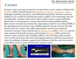 Dr Himanshu Shah | Varicose vein Mumbai | PPTX