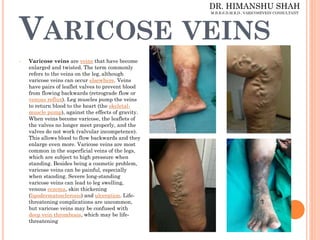 Dr Himanshu Shah | Varicose vein Mumbai | PPTX