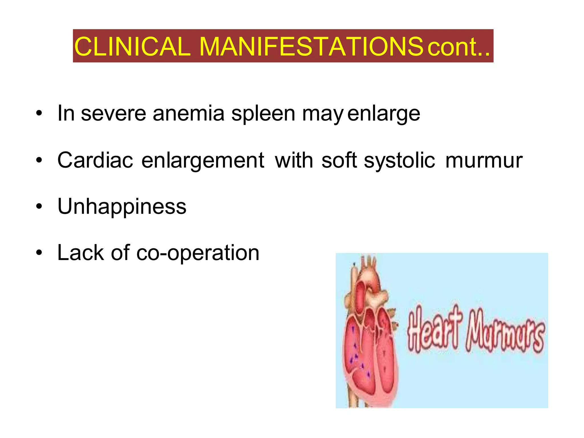 REVIEW OF ANEMIA | PPTX