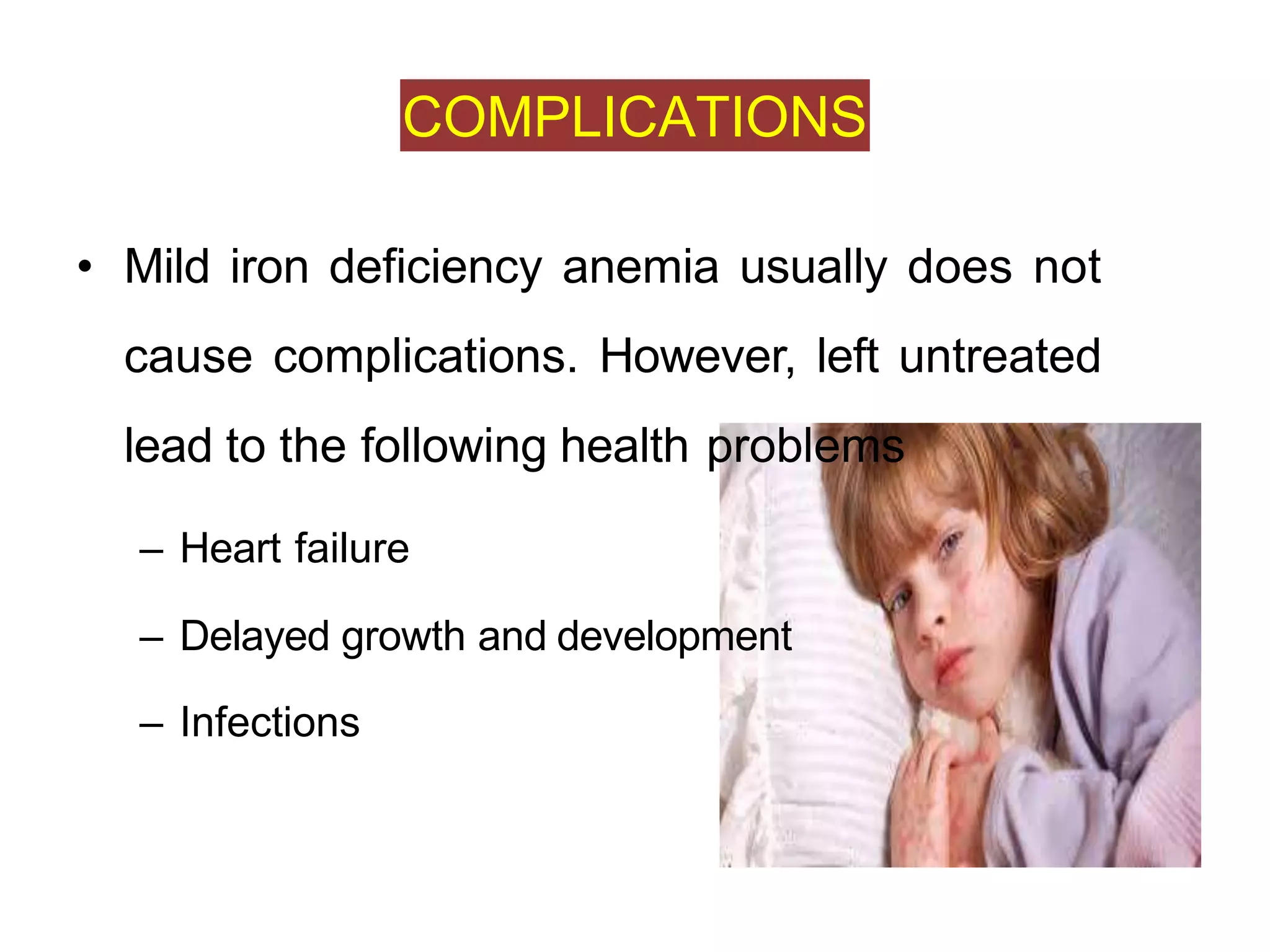 REVIEW OF ANEMIA | PPTX