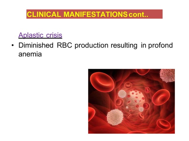 REVIEW OF ANEMIA | PPT