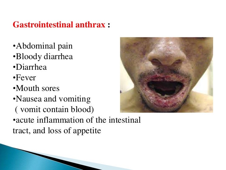 Gastrointestinal Anthrax Symptoms Anthrax (Bacillus Anthracis)