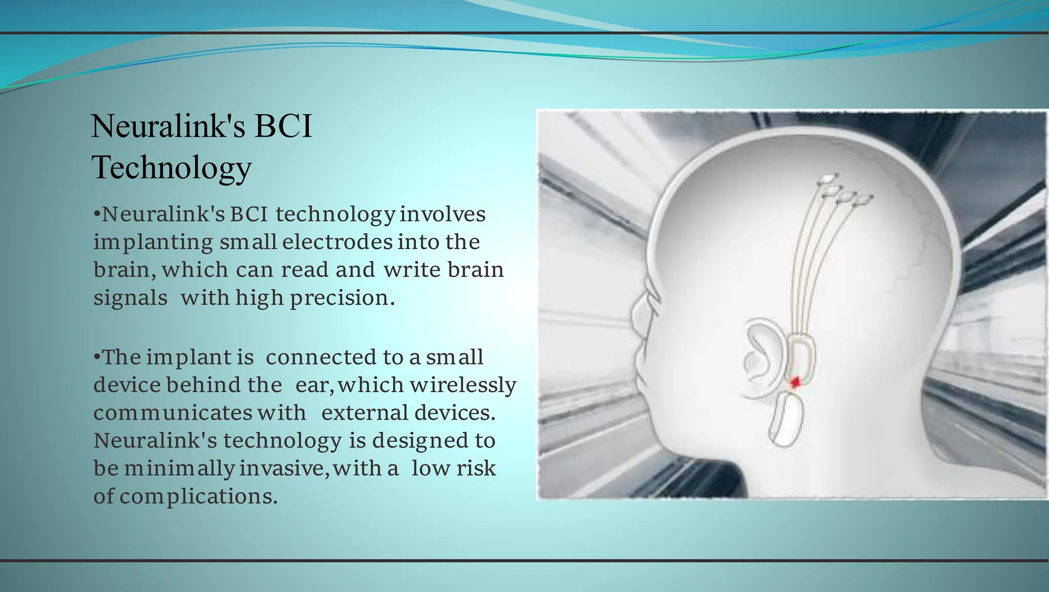 ppt on the brain chip neuralink.pptx