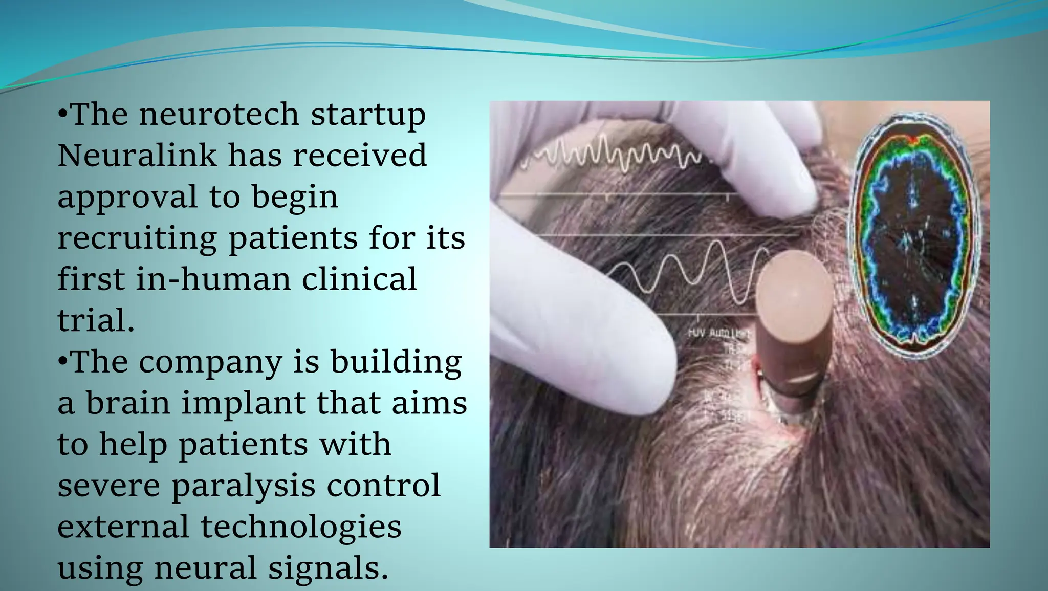 ppt on the brain chip neuralink.pptx