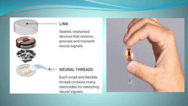 ppt on the brain chip neuralink.pptx | Brain and Nervous System ...