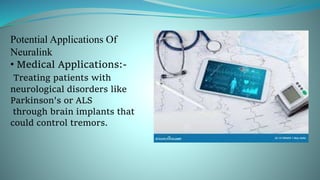 ppt on the brain chip neuralink.pptx