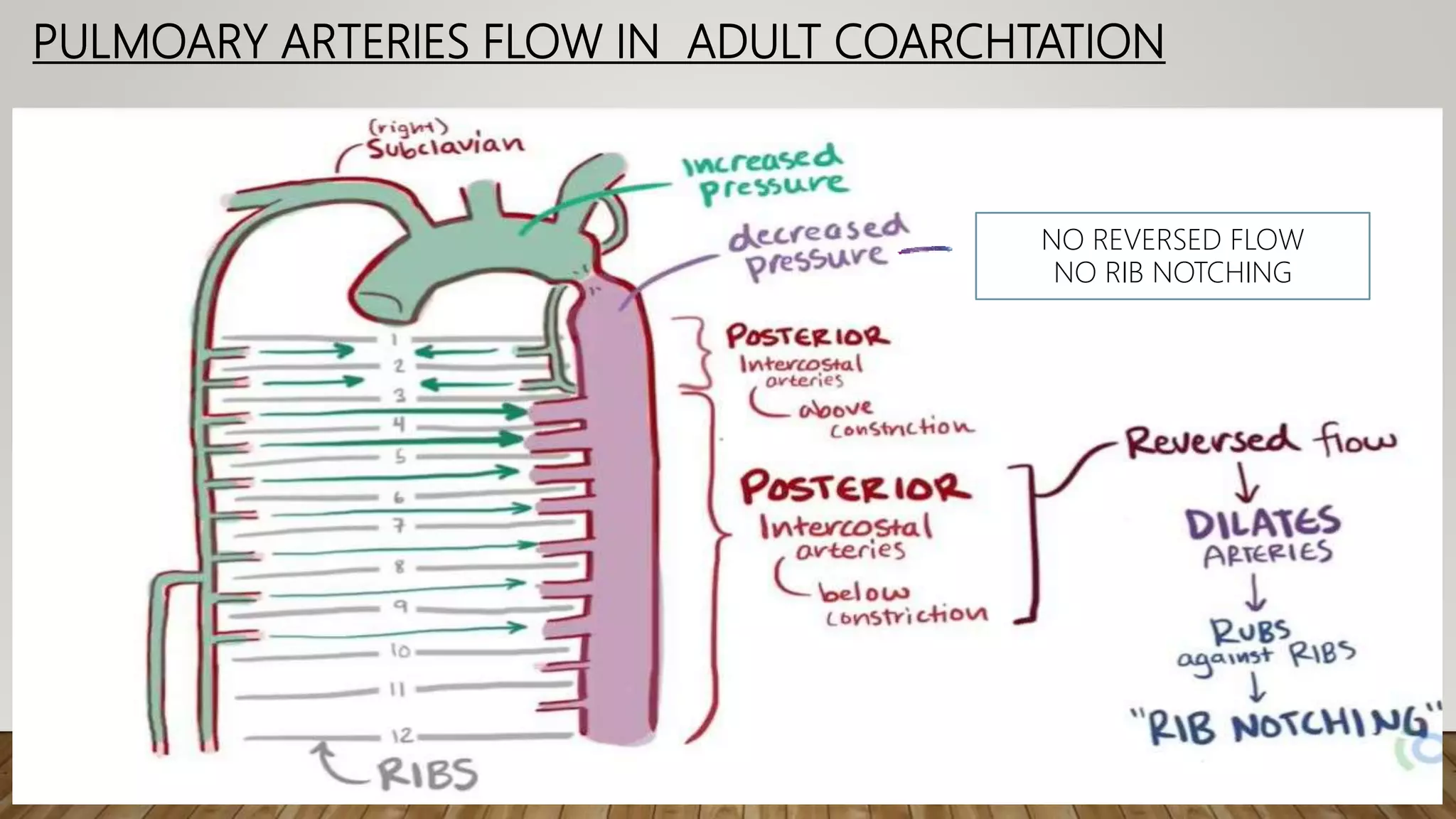 Coarctation of aorta |CONGENITAL HEART DEFECT | PPTX