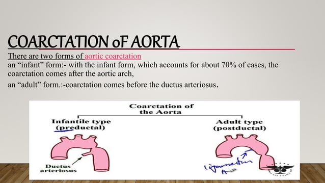 Coarctation of aorta |CONGENITAL HEART DEFECT | PPTX