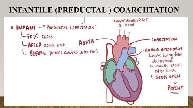 Coarctation of aorta |CONGENITAL HEART DEFECT | PPTX