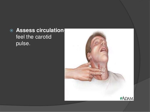 Ppt on cpr