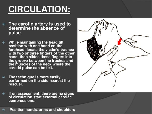 Ppt on cpr