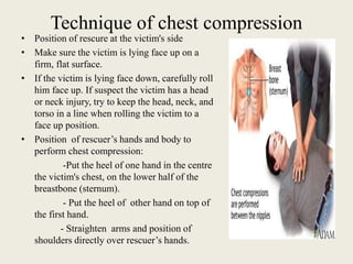 cardiopulmonary resuscitation | PPT