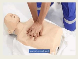 cardiopulmonary resuscitation | PPTX